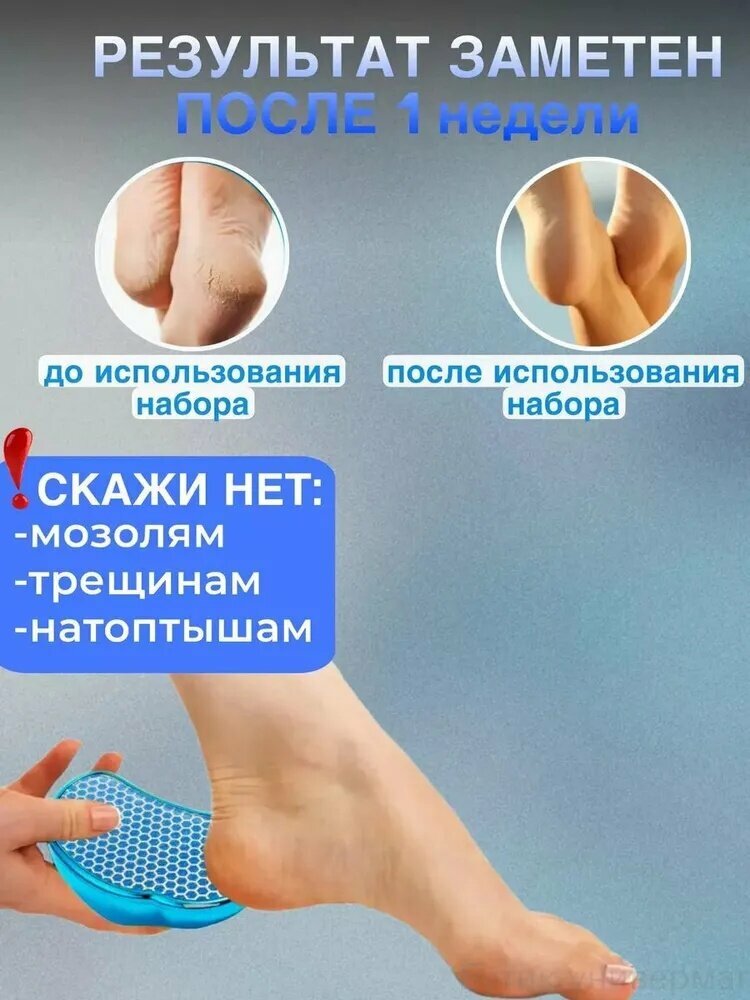 Терка для пяток — фото 1