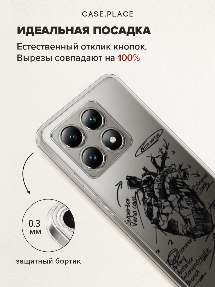 Чехол на Xiaomi 14T / Сяоми 14T с принтом "Анатомическое сердце 2", прозрачный — фото 1