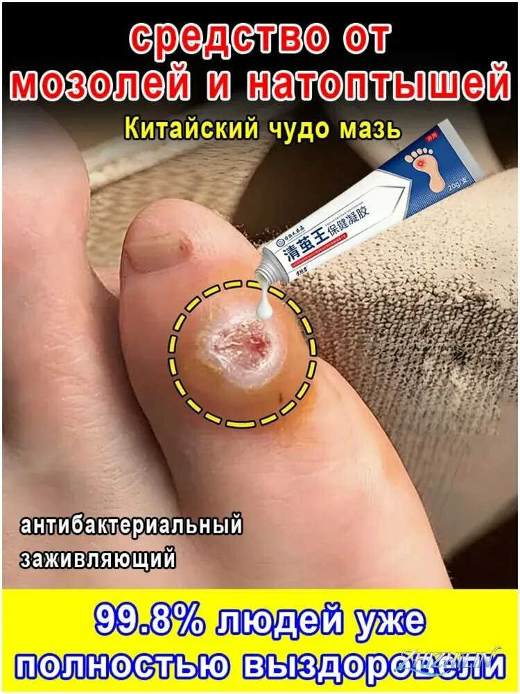 Пластырь от мозолей, стержневых натоптышей и бородавок 20 г Китайский чудо мазь