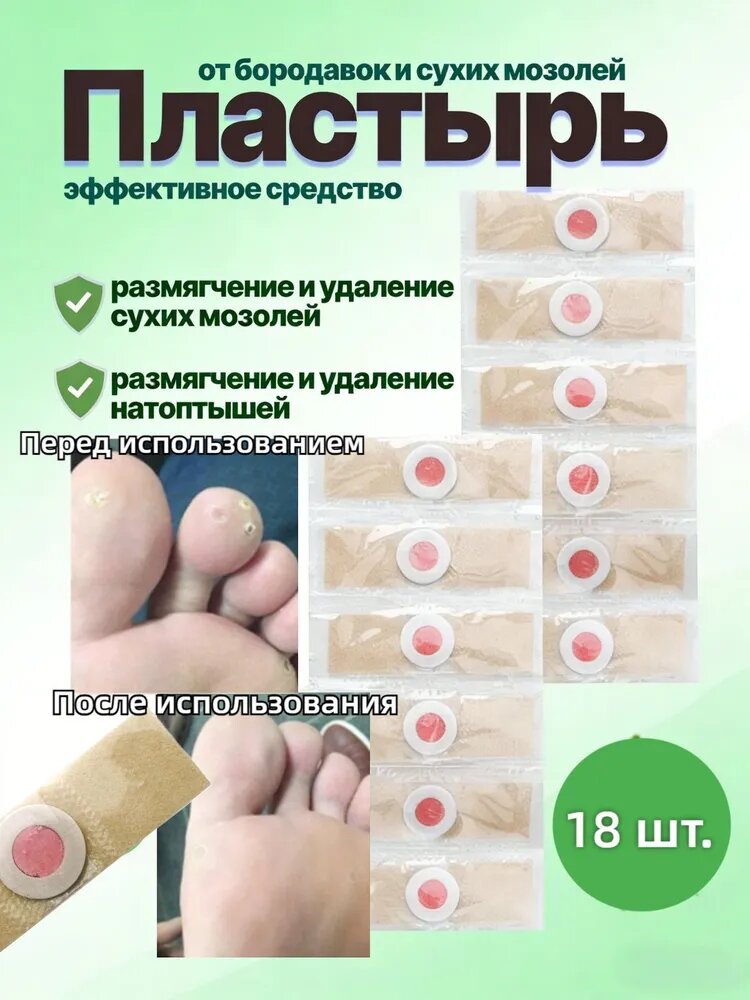 Пластырь от сухих мозолей и пяточной шпоры