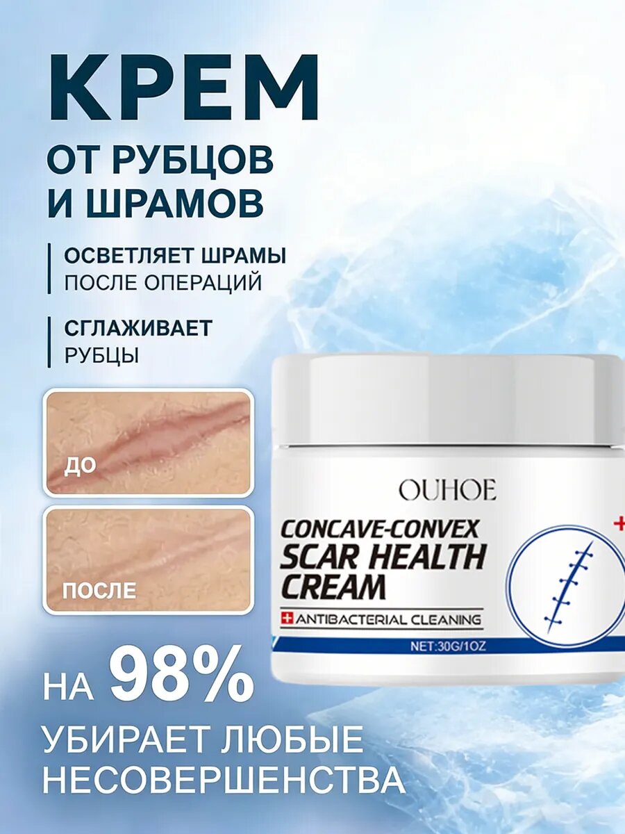 Крем от шрамов и рубцов от растяжек, с алоэ вера, для всех типов кожи