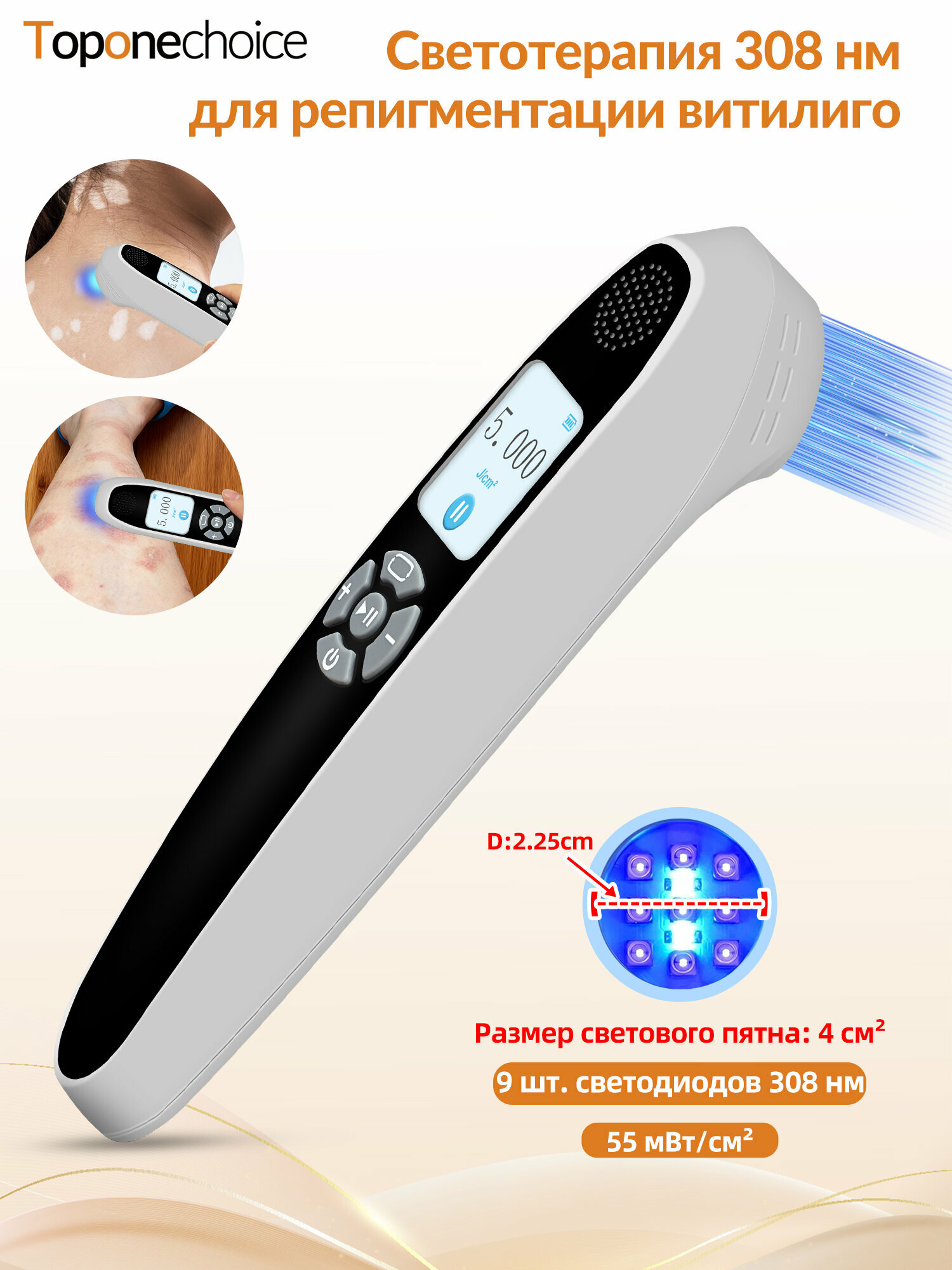 Toponechoice PD02 фототерапия Лампа 308nm UVB от псориаза и экземы