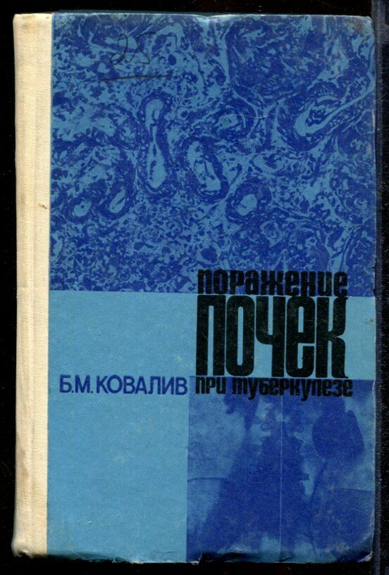 Ковалив Б. - Поражение почек при туберкулезе | Клиника и лечение. - 1970