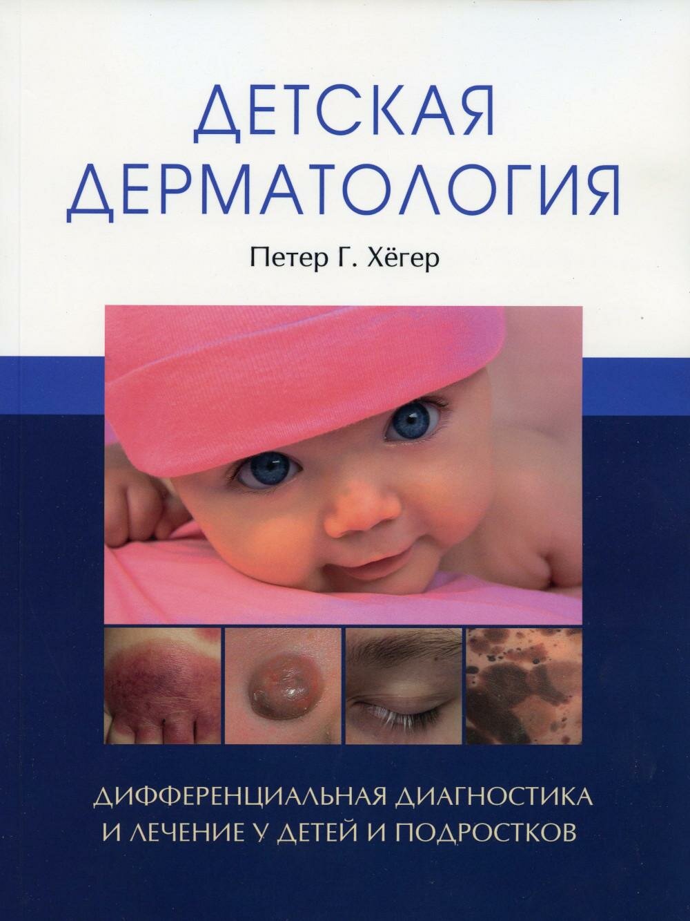 Детская дерматология. (обл.) Дифференциальная диагностика и лечение у детей и подростков, Хегер П. Г, ИЗД. панфилова
