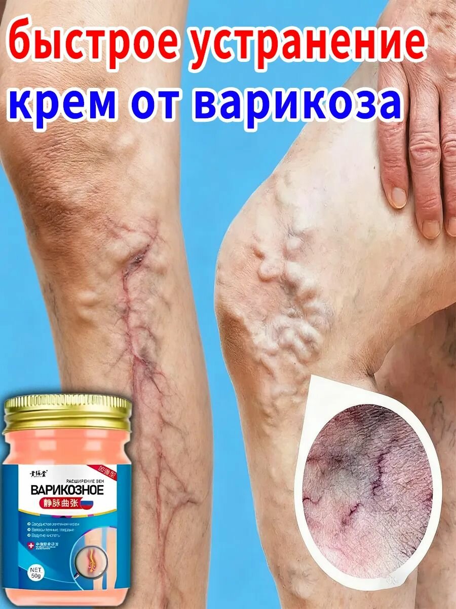 Крем гель для ног, от отеков и вен на ногах, тонизирующая охлаждающая мазь комфорт, купаж для усталых ног