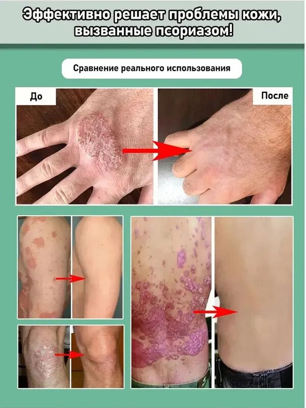 Твердое мыло куском — фото 1