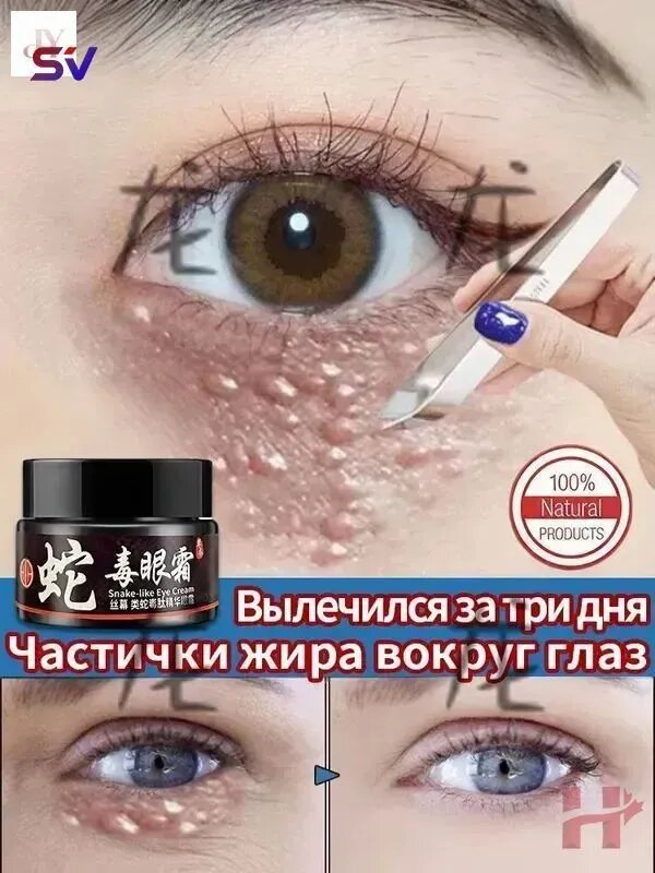 Средство от милиумов на лице, Крем для век антивозрастной, для зоны вокруг глаз, от темных кругов и морщин, отё