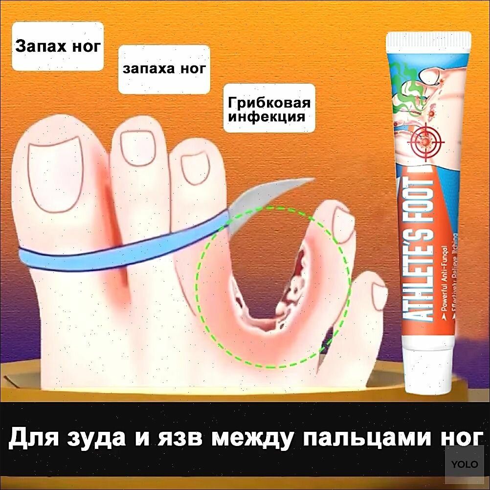 Средство от запаха ног для зуда и язв между пальцами, против грибка, дезодорант эффективное 20г