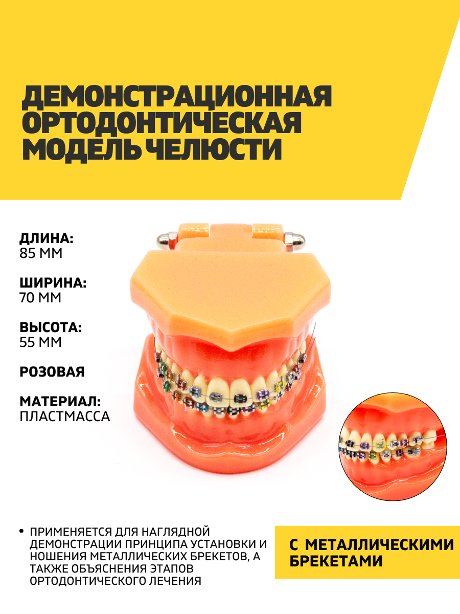 Демонстрационная ортодонтическая модель челюсти с металлическими брекетами, розовая