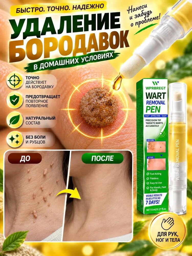 Карандаш от папиллом и бородавок, уход за проблемной кожей, быстрое действие, без боли, подходит для шеи, лица, рук и тела, 50мл