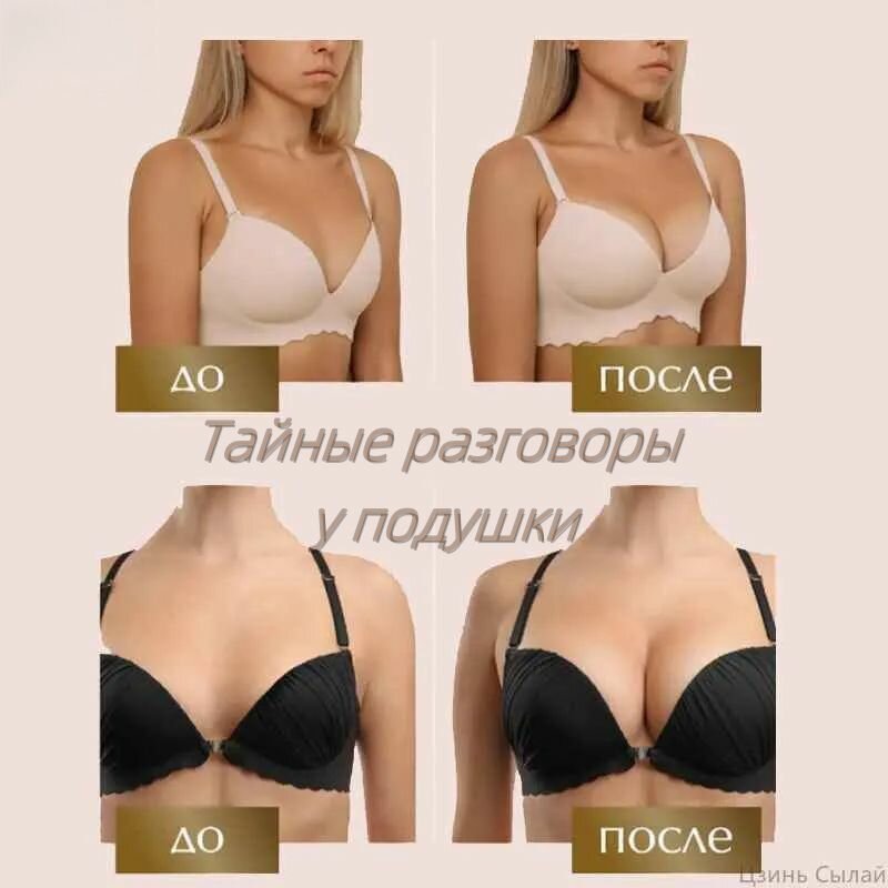 Средство от растяжек — фото 1