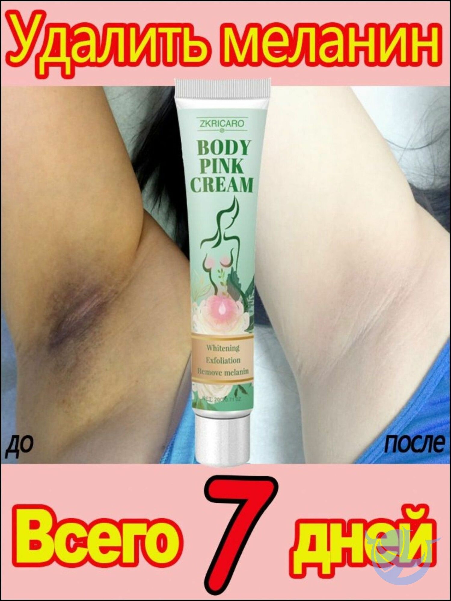 Отбеливающий крем подходит для интимных зон, тела, ягодиц, подмышек, коленей и локтей, удаляет пигментацию, пигментные пятна и уменьшает тусклость кожи, 20 мл