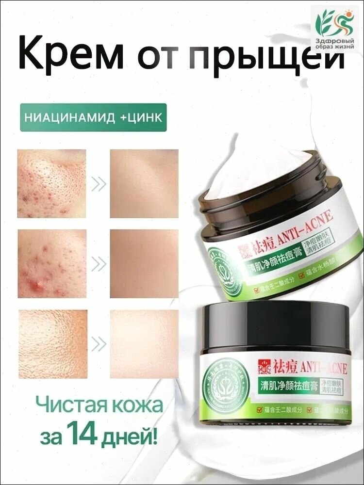 Крем против угревой сыпи, борется с прыщами, воспалениями, быстрое заживление постакне, для подростков и взрослых, 30 г