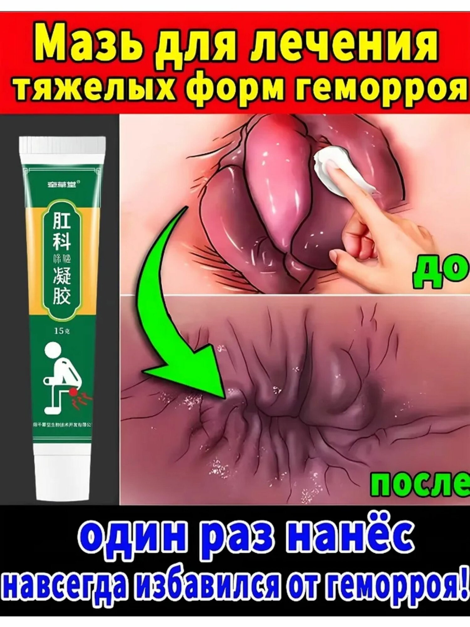 Китайская чудо мазь от геморроя, 100% натуральная, не гормональная, крем от геморроя Чжи Чуан Гао 15 г