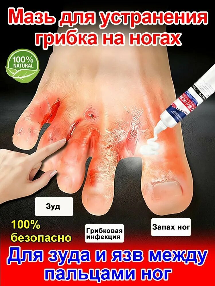 Крем от грибка ног между пальцев, удаляет грибки, мазь для лечения зуда и язв, неприятного запаха ног, 20 г