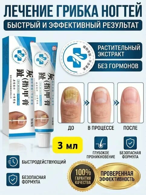 3шт Сильная эссенция для лечения грибка ногтей, удаление грибка ногтей на ногах