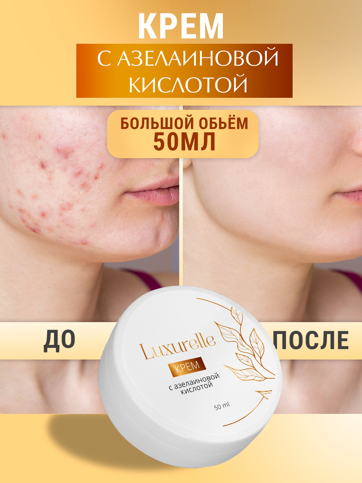 Luxurelle Крем для лица азелаиновый для всех типов кожи с гиалуроновой и азелаиновой кислотой, витамином Е увлажняющий, от прыщей, воспалений на лице анти-акне, 50 мл