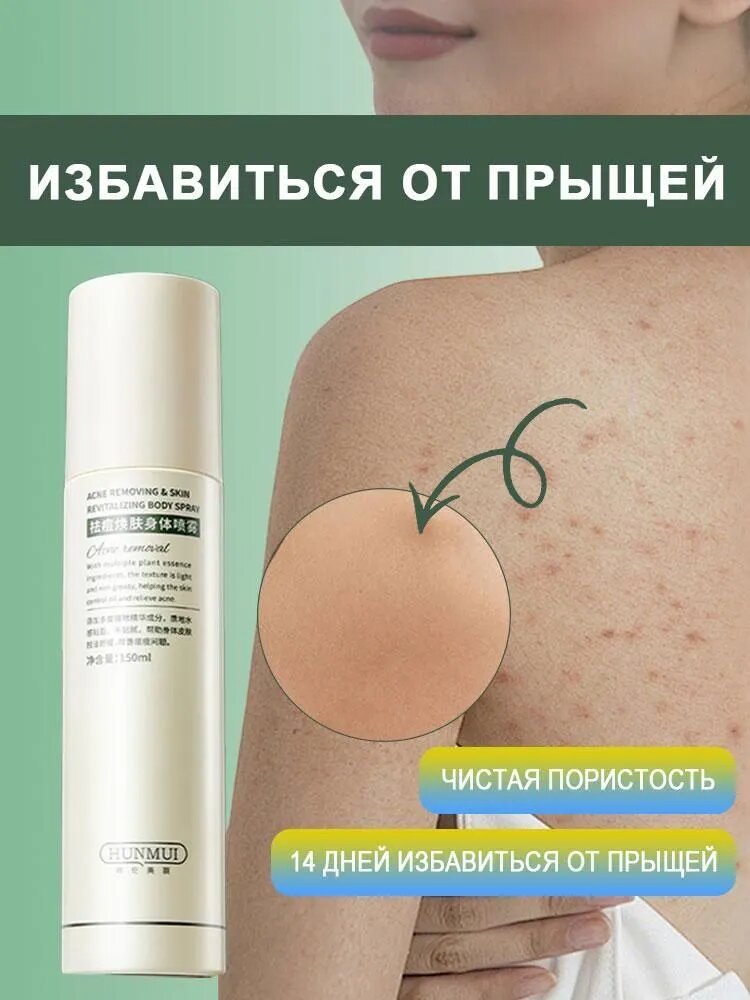 Сыворотка-спрей для тела, от прыщей акне и воспалений,150мл