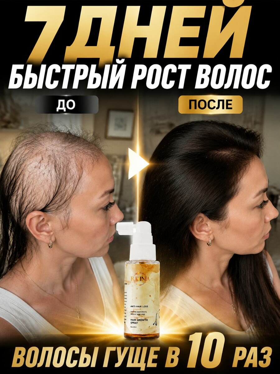 RAVINIA спрей для роста волос 60 мл спрей для роста волос против выпадения, укрепляющая сыворотка-тоник для корней, активатор густоты для мужчин и женщин