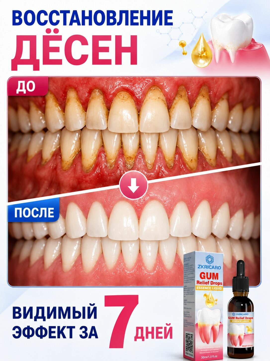 Эффективно против рецессии дёсен, быстро снимает воспаление, чувствительность, кровоточивость и боль, капли для ухода за полостью рта, 30 мл