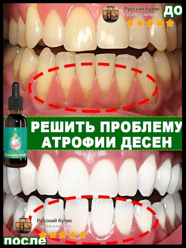 Эфирные масла для ухода за полостью рта при атрофии десен, чувствительности зубов, стоматите и уходе за деснами. Растительные экстракты. Антибактериальные средства по уходу за полостью рта.30 мл