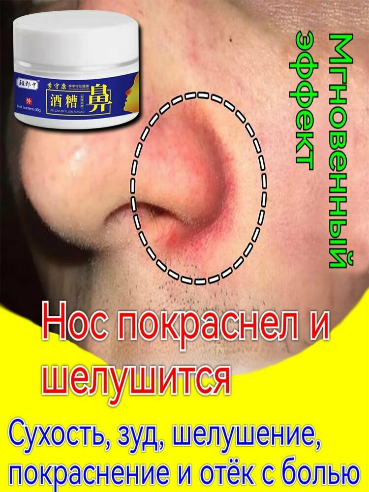 Восстанавливающий крем против покраснения, шелушения и сухости кожи носа,30 г