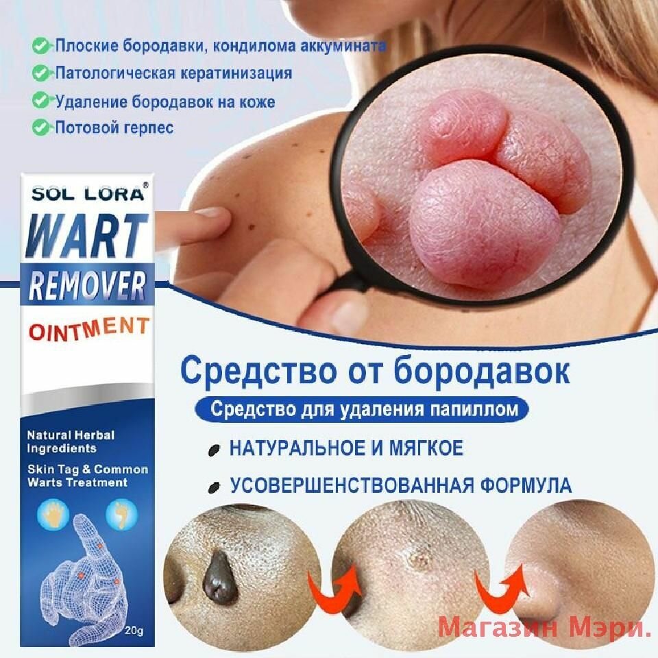 Крем от папиллом и бородавок/Средство для удаления бородавок, папиллом и родинок, от папиллом и бородавок на проблемной коже лица, рук и ног, мазь с чистотелом, 20 г