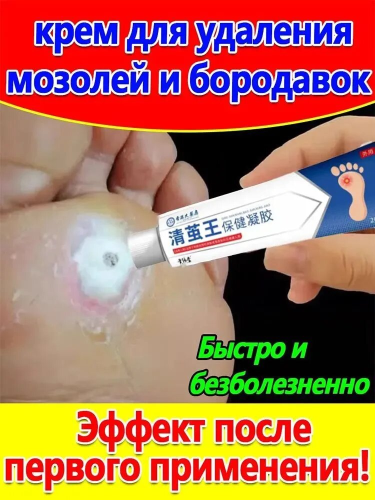 Чудодейственная мазь для удаления мозолей. Кератолитик -применяется при длительных проблемах с кожей стоп -используется для удаления трещин, натоптышей, мозолей, 20 грамм.