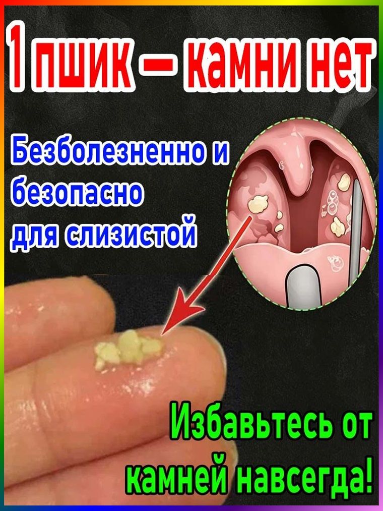 Прибор и спрей для очистки миндалин от пробок