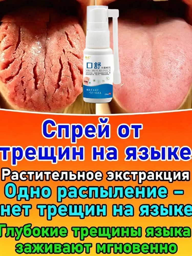 Спрей от трещин на языке и сухости во рту увлажняет и успокаивает раздражённую слизистую