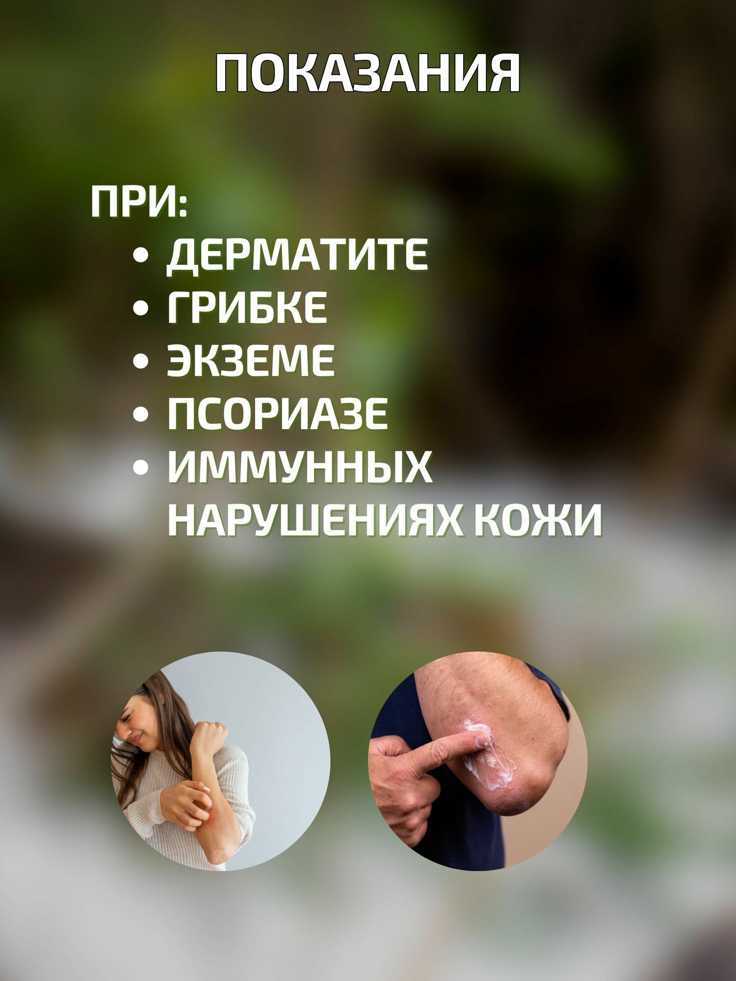 Мазь "Чистая кожа" против псориаза 60 гр, Травник Гордеев М. В