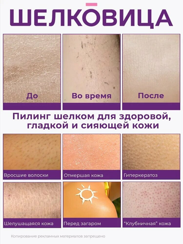 Мочалка — фото 1