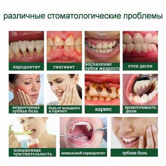 Спрей для полости рта — фото 1