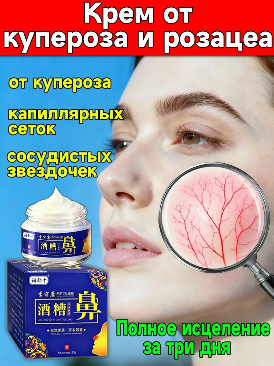 Мазь от Китайский розацеа на лице купероза и покраснений