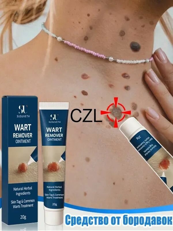 7 дней без следов удаление Мазь от бородаво / Крем средство для удаления бородавок, папиллом и родинок, безболезненно, не оставляет следов / 20г от бородавок средство