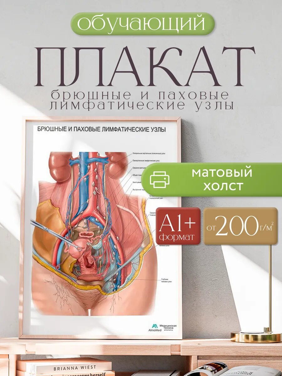 Брюшные и паховые лимфатические узлы плакат, матовый холст от 200 г/кв. м, размер A1+