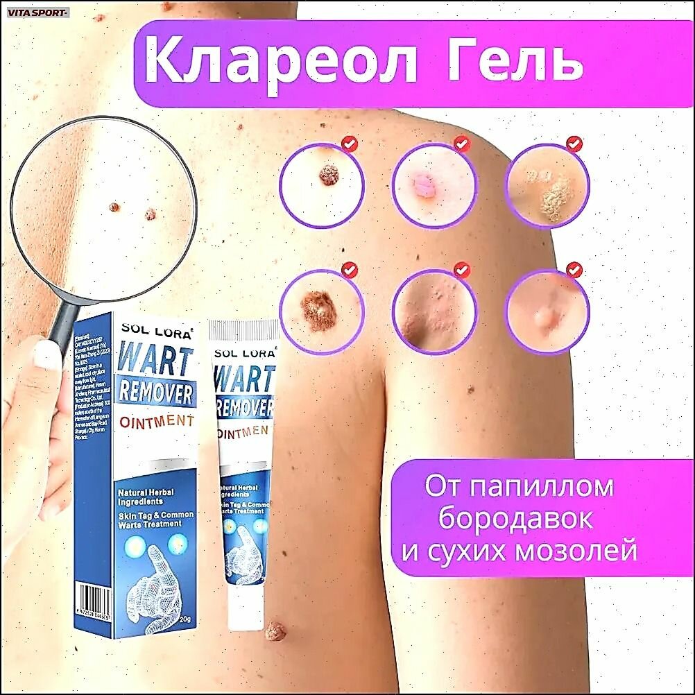 Средство от папиллом и бородавок, мазь для ухода за кожей, крем от родинок, Натуральные растительные ингредиенты