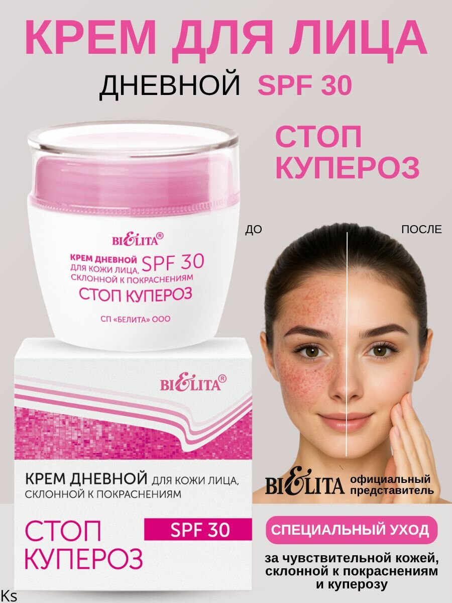 Белита Стоп Купероз Крем дневной для кожи лица, склонной к покраснениям SPF30, 50 мл