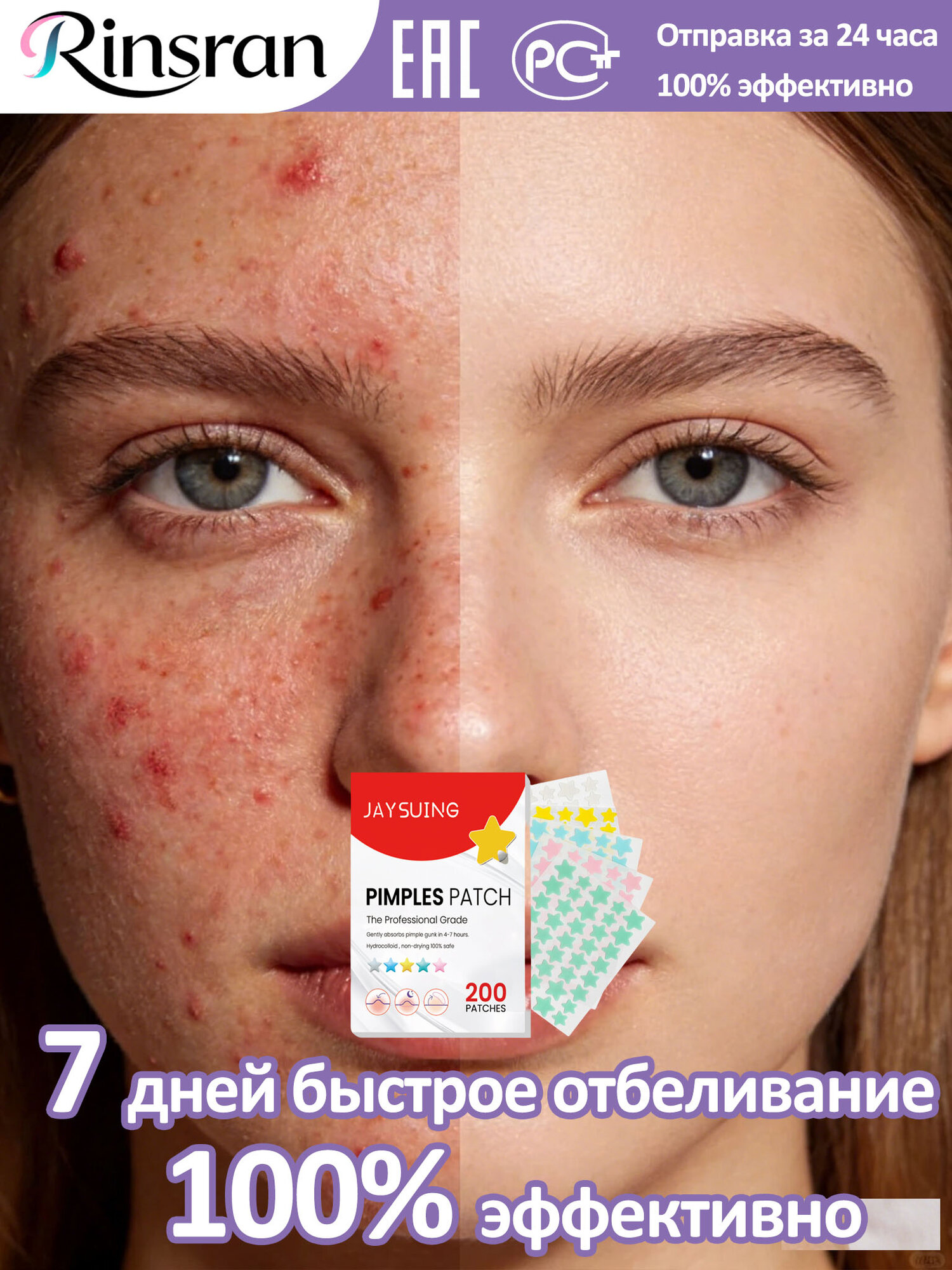 Патчи от прыщей гидроколлоидные / наклейки от прыщей в виде звездочек