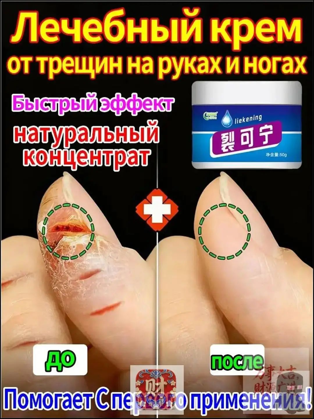 Заживляющий бестселлер для пальцев и рук