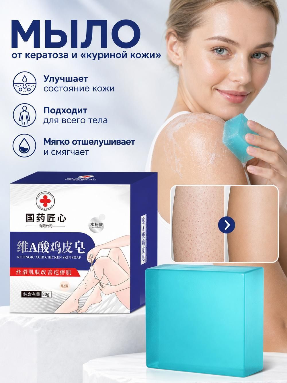 Мыло с ретиноевой кислотой может улучшить состояние при кератозе пиларис по всему телу.