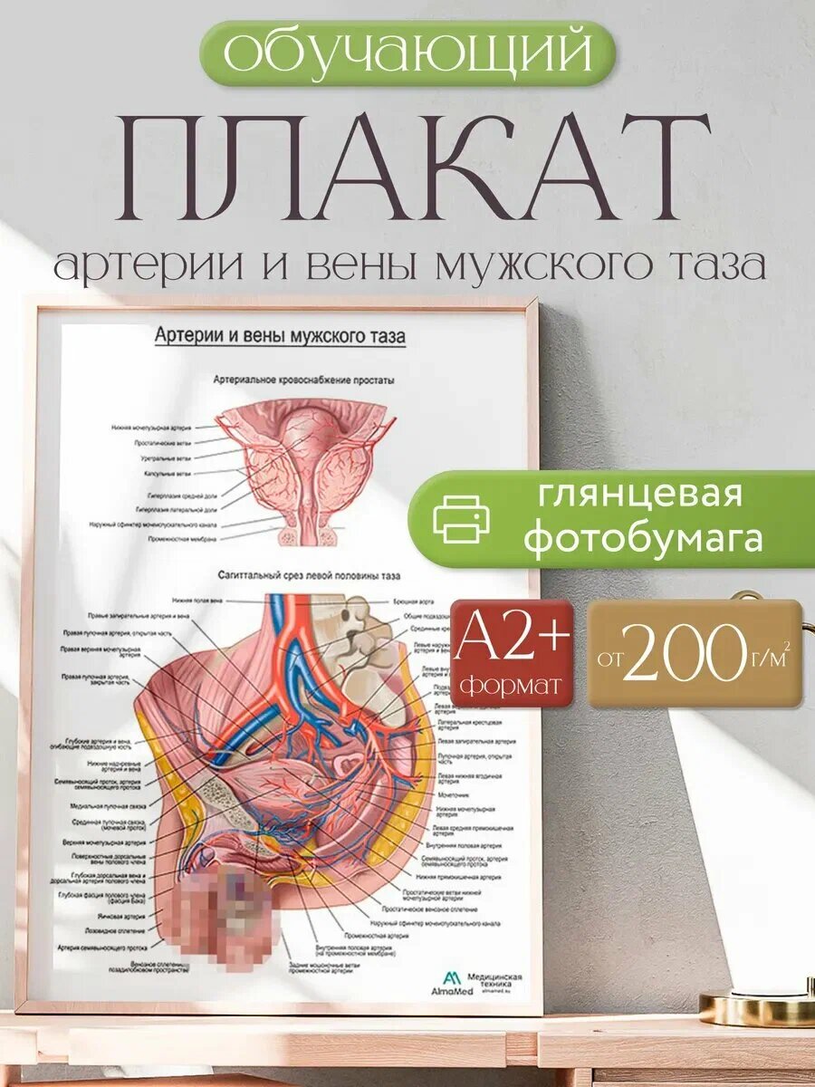 Артерии и вены мужского таза, плакат глянцевый А2+, плотная фотобумага от 200г/м2