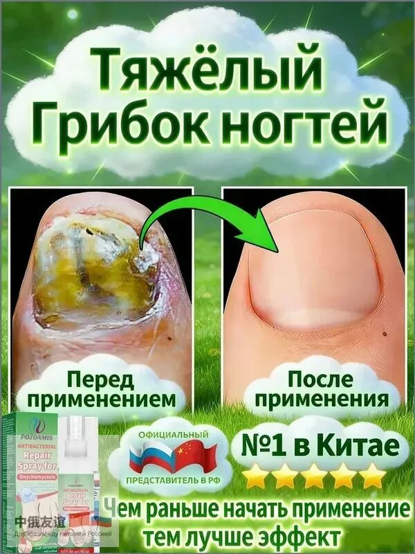 Спрей от онихомикоза масло от грибка ногтей на ногах. Средство от грибка ногтей на ногах