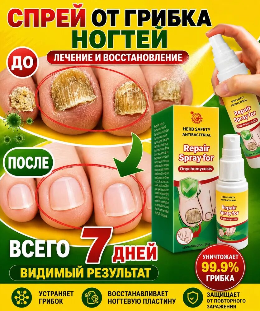 VANYOR Repair Spray Спрей для ногтей при грибковых проблемах, уход за поврежденной ногтевой пластиной рук и ног.5 коробка