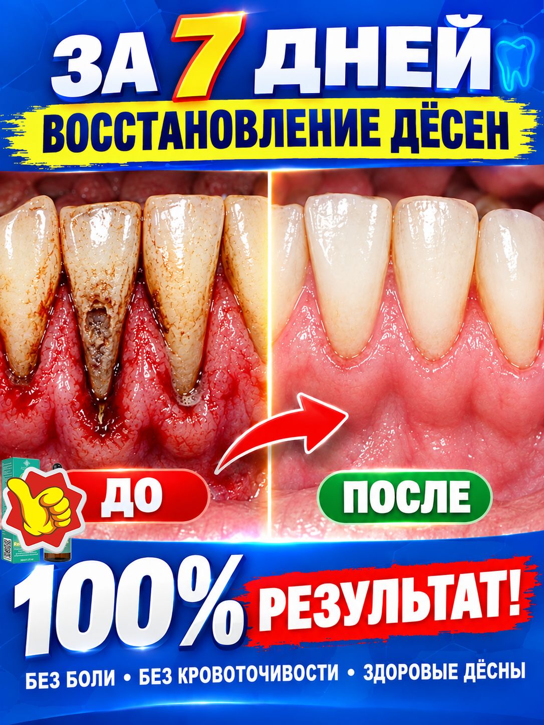 Используется для лечения пародонтита, стоматита, снятия чувствительности и отека десен, восстановления, профилактики и укрепления поврежденных десен, 30 мл