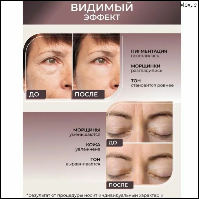 Dr.pen Косметологический аппарат ULTIMA-A10-W Машина для мезодерма терапии с точечной матрицей