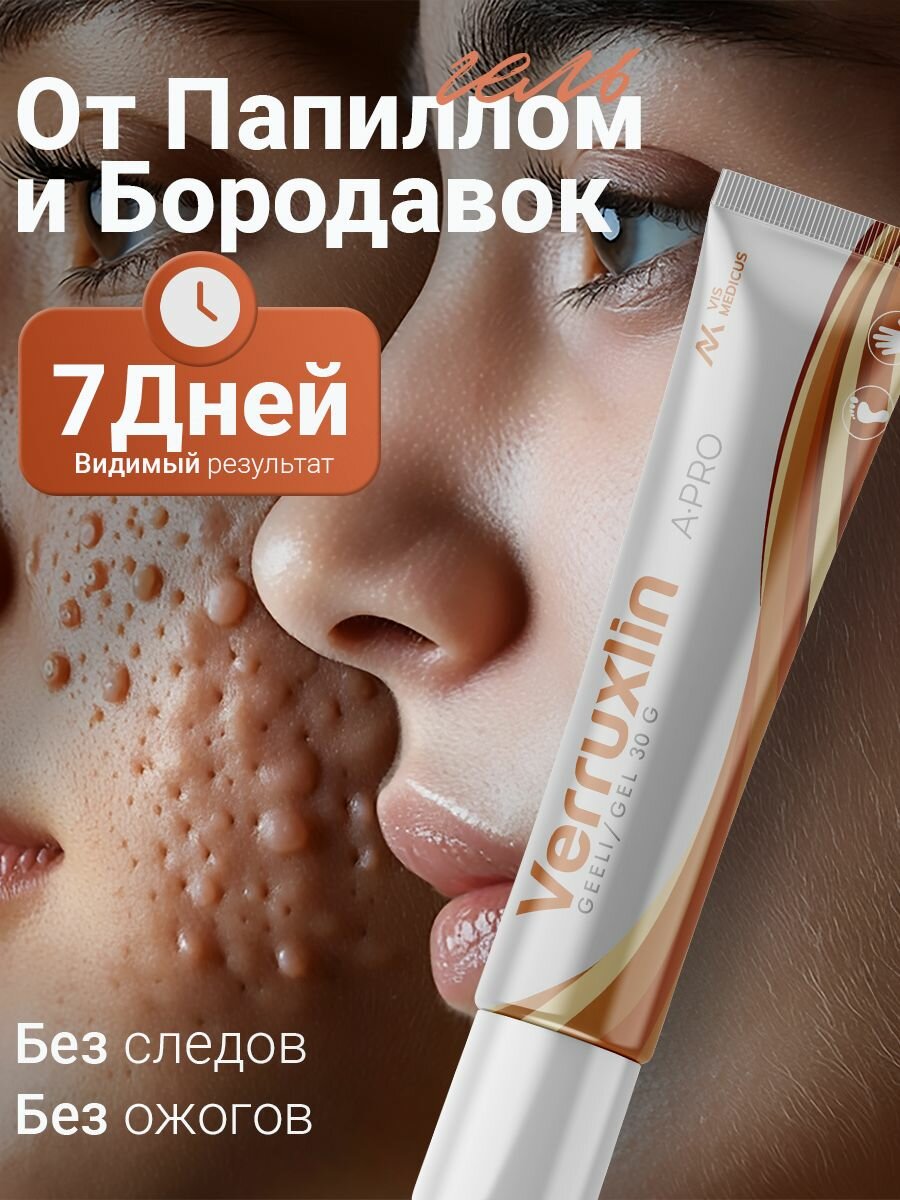VERRUXLIN от папиллом / Гель от бородавок, чистотел от папиллом, для тела, для рук, для шеи, чистотел от бородавки, мазь от сухих мозолей, veruxin / 30 мл
