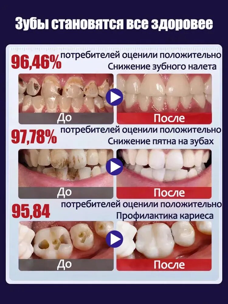 Быстро удаляют зубной камень, Удаляет желтые зубы, неприятный запах изо рта, зубной налет и пятна от дыма 150 г.