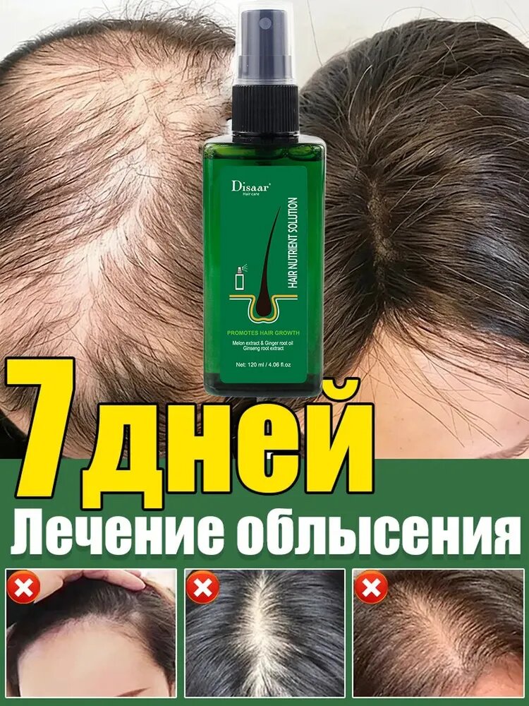 Профессиональный спрей для роста волос, эффективно стимулирует фолликулы, ускоряет рост и предотвращает выпадение, 120 мл