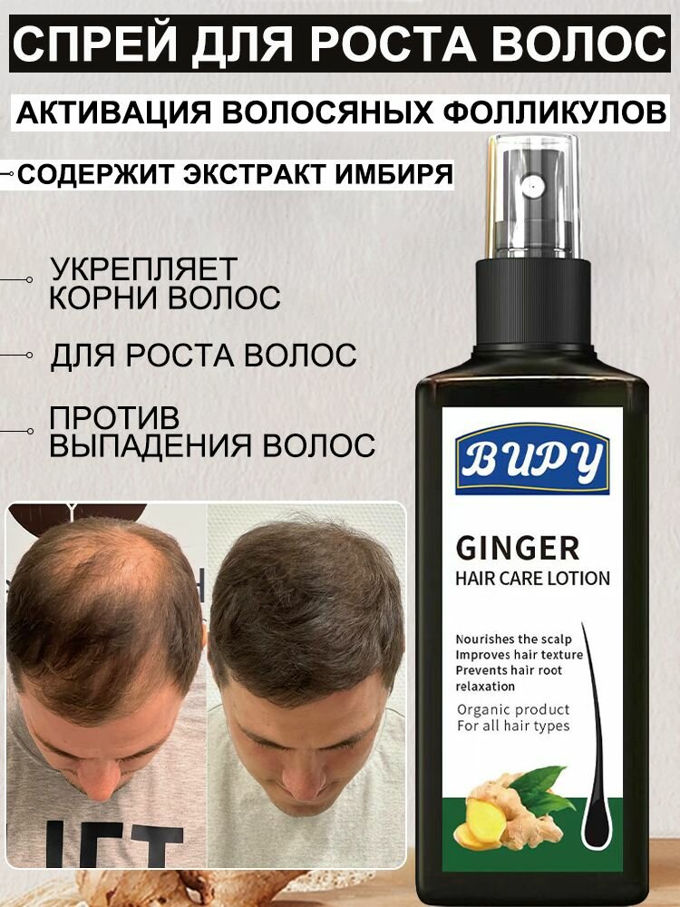 Мощный спрей для роста волос, активатор роста и густоты волос, для укрепляющий от выпадения 120 мл